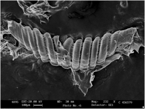 Do snails have teeth? | Facts About Snails